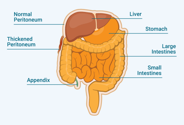 peritoneal reflections